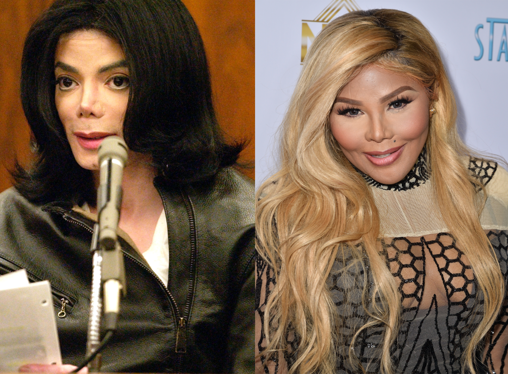 Who's That? Shocking Plastic Surgery Transformations